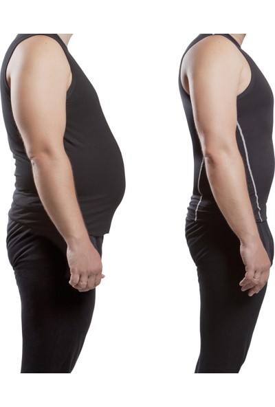 Miorre Erkek Göbek Korsesi