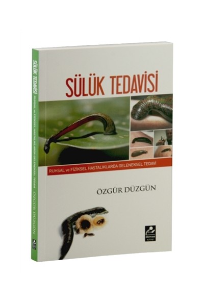 Ruhsal ve Fiziksel Hastalıklarda Geleneksel Tedavi - Sülük Tedavisi - Özgür Düzgün Ruhsal ve Fiziksel Hastalıklarda Geleneksel Tedavi - Sülük Tedavisi - Özgür Düzgün