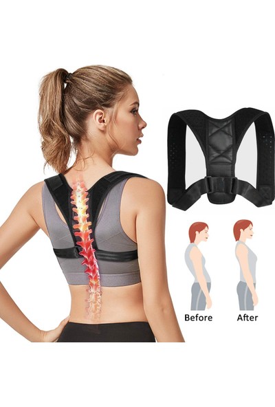 Ankaflex Ortobedik Medikal Kifoz Korsesi Skolyoz Dik Durus Korsesi Kemeri Kambur Önleyici Düzeltici Ankaflex Ortobedik Medikal Kifoz Korsesi Skolyoz Dik Durus Korsesi Kemeri Kambur Önleyici Düzeltici