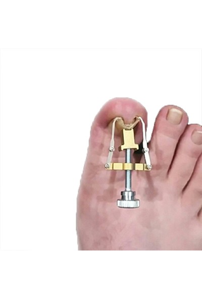 Skygo Batık Tırnak Düzeltme Aleti