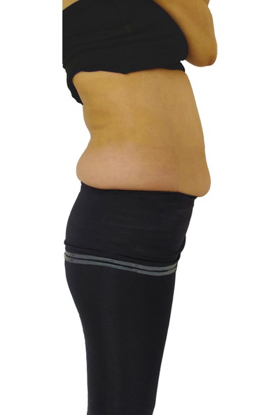 Tangmoda Silikonlu Kadın Toparlayıcı Korse Tayt Inceltici Siyah Lohusa Korse