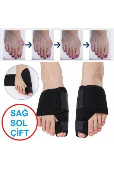 Ankaflex Halluks Gece Ateli Ayak Baş Parmak Kemik Çıkıntısı Düzeltici