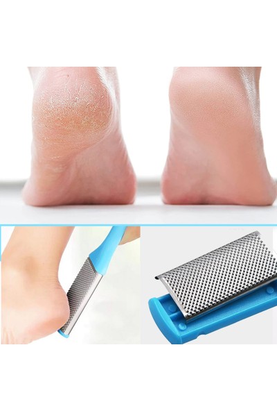 Xolo Ayak Topuk Ölü Deri Rende Törpüsü Çift Taraflı XL69