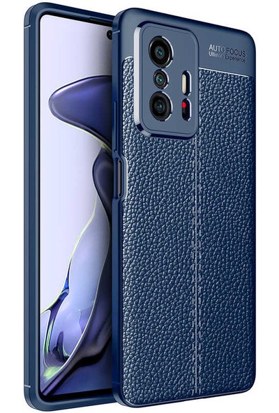 MobaxAksesuar Xiaomi Mi 11T 5g Kılıf Deri Tarzı Niss Silikon Case Lacivert MobaxAksesuar Xiaomi Mi 11T 5g Kılıf Deri Tarzı Niss Silikon Case Lacivert