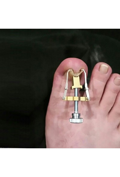 Arizzonna Ayak Batık Tırnak Düzeltme Aleti