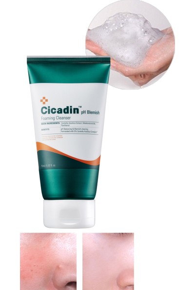Zayıf Asidik Yağlanma Karşıtı Temizleme Köpüğü Cicadin Ph Blemish Foaming Cleanser Zayıf Asidik Yağlanma Karşıtı Temizleme Köpüğü Cicadin Ph Blemish Foaming Cleanser