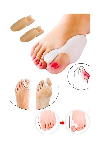 Kitchen Beauty Silikon Makaralı Ayak Baş Parmak Kemik Bunyon Koruyucu Kemik Çıkıntısı Önleyici Kitchen Beauty Silikon Makaralı Ayak Baş Parmak Kemik Bunyon Koruyucu Kemik Çıkıntısı Önleyici