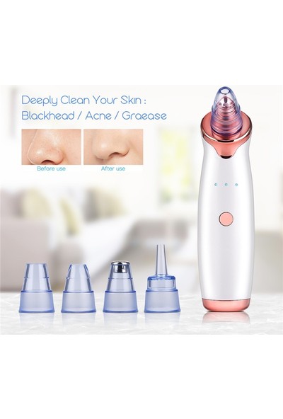Generic Ultrasonik Cilt Scrubber Yüz Cilt Spatula Pore Temizleyici Cilt Peeling + Siyah Noktası Remover Nano Bay Yüz Temizleme Fırçası | Cilt Scrubber (Yurt Dışından) Generic Ultrasonik Cilt Scrubber Yüz Cilt Spatula Pore Temizleyici Cilt Peeling + Siyah Noktası Remover Nano Bay Yüz Temizleme Fırçası | Cilt Scrubber (Yurt Dışından)