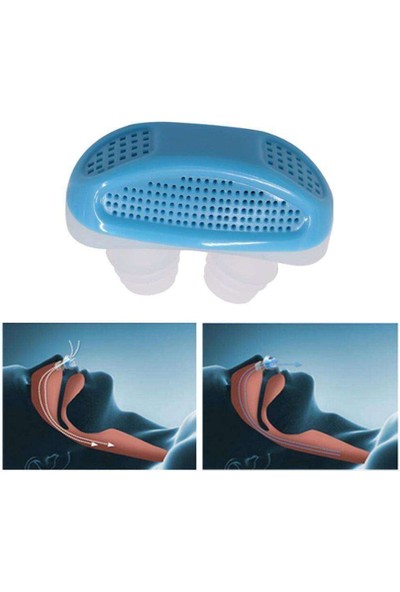 Horlama Önleyici Aparat