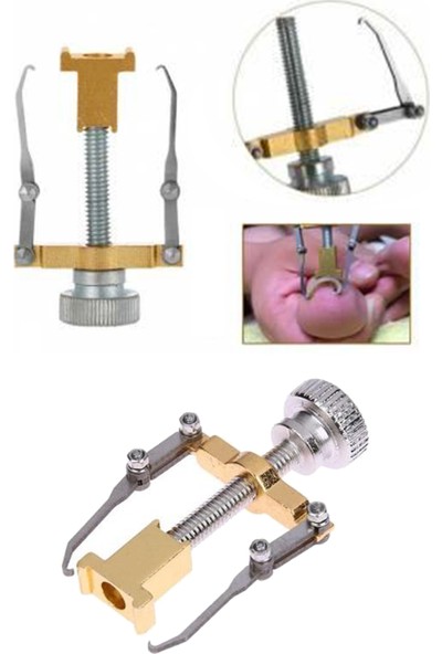 Buffer Batan Tırnak Düzeltme Aleti Batık Tırnak Çıkarıcı Aparat Buffer Batan Tırnak Düzeltme Aleti Batık Tırnak Çıkarıcı Aparat