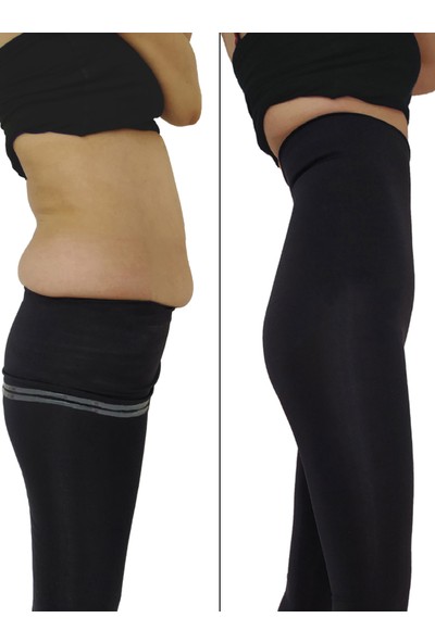 Young&Fit Korse Tayt Siyah Kadın Tayt Göbek Basen Toparlayıcı Tayt Doğum Sonrası Korsesi Spor Taytı Young&Fit Korse Tayt Siyah Kadın Tayt Göbek Basen Toparlayıcı Tayt Doğum Sonrası Korsesi Spor Taytı