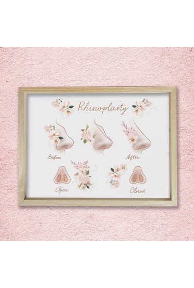 Burun Estetiği, Plastik ve Estetik Cerrahı, Doktor Odası Duvar Tablosu Burun Estetiği, Plastik ve Estetik Cerrahı, Doktor Odası Duvar Tablosu