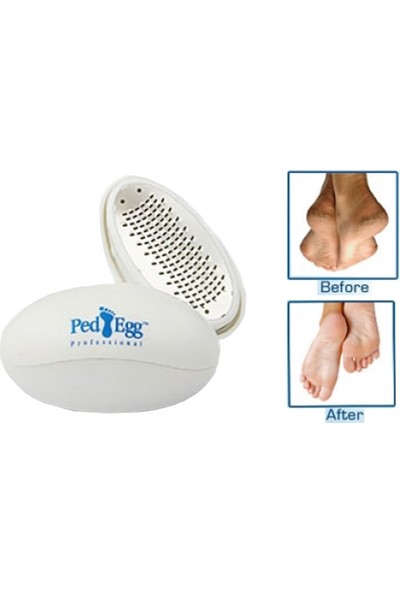 Ped Egg Topuk Törpüsü Ped Egg Topuk Törpüsü