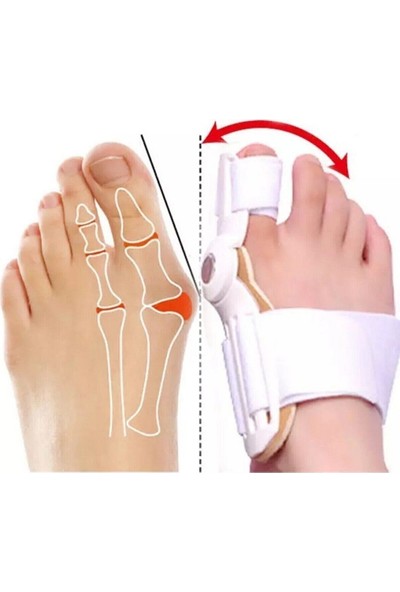 Baş Parmak Kemik Düzeltici Baş Parmak Kemik Düzeltici
