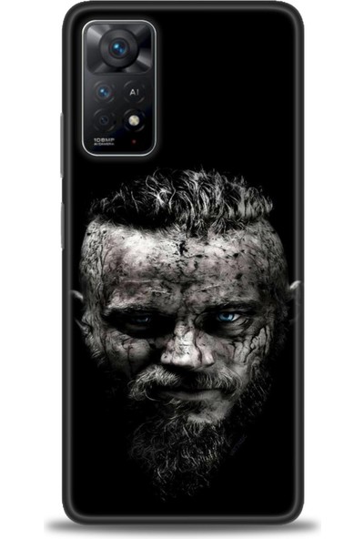 Ahk Xiaomi Redmi Note 11 Pro 5g Kılıf Hd Baskılı Kılıf - Ragnar