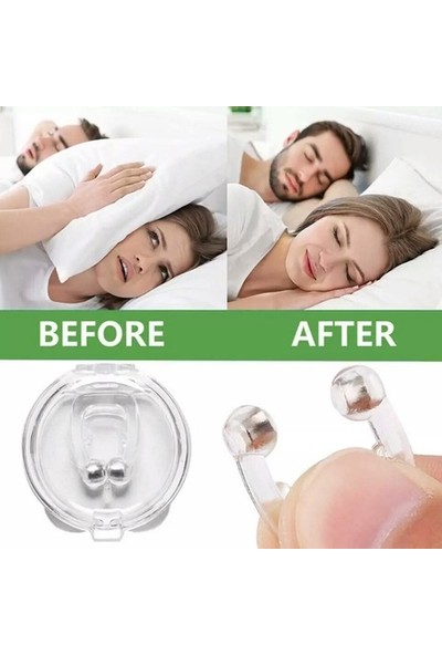 Aref Horlama Önleyici Burun Aparatı Nefes Açıcı Burun Aparatı