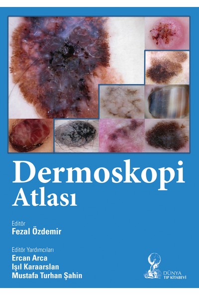 Dermoskopi Atlası - Ercan Arca Dermoskopi Atlası - Ercan Arca