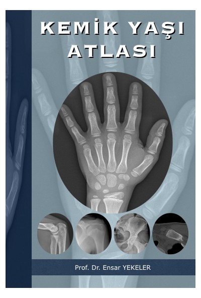 Kemik Yaşı Atlası - Ensar Yekeler Kemik Yaşı Atlası - Ensar Yekeler