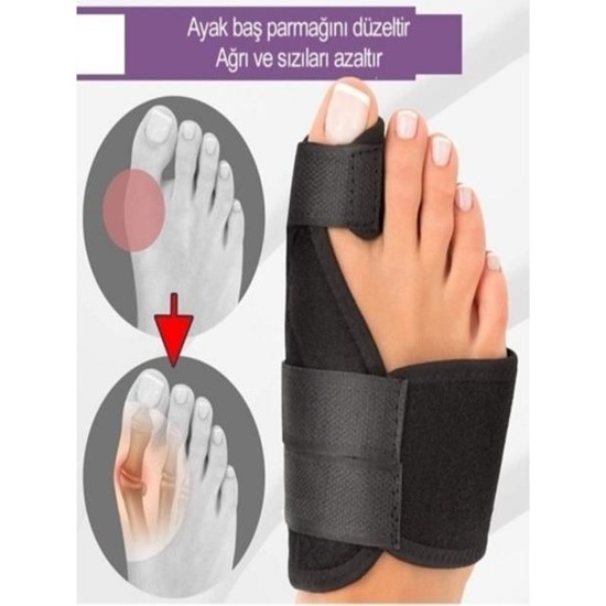 Ankaflex Halluks Gece Ateli Ayak Baş Parmak Kemik Çıkıntısı Fiyatı