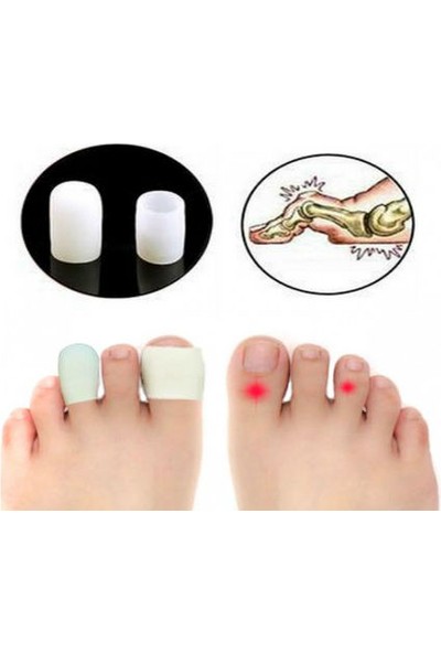 Wildlebend Ayak Parmağı Kemik Koruma Silikonu Wildlebend Ayak Parmağı Kemik Koruma Silikonu