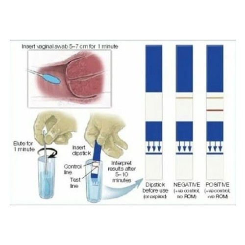 Amnisure Fetal Membran Yırtığı Testi Fiyatı - Taksit Seçenekleri