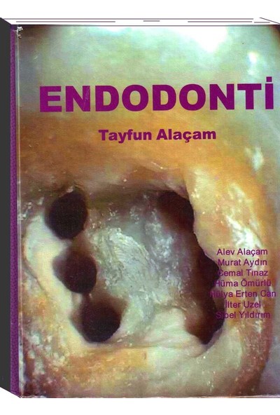 Endodonti - Tayfun Alaçam Endodonti - Tayfun Alaçam