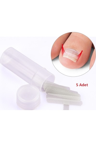 Invoker - Tırnak Batması Önleyici Batık Tırnak Gevşetici Esnek Plastik Aparat