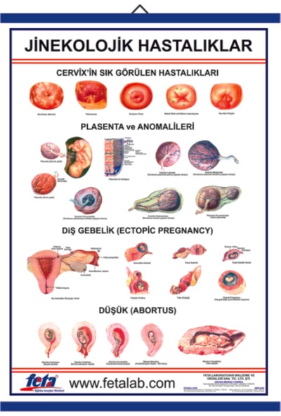 Edulab Jinekolojik Hastalıklar Eğitim Plakası