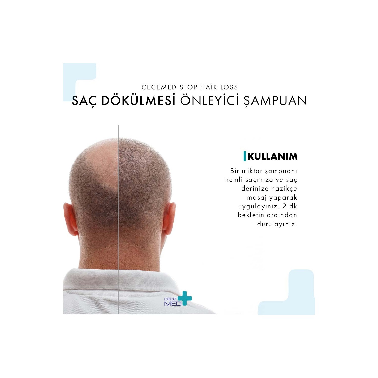 Cecemed Stop Hair Loss Shampoo 300 Ml Fiyatı Taksit Seçenekleri