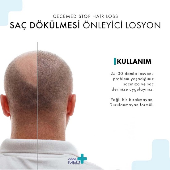 Cecemed Stop Hair Loss Lotion Saç Dökülme Karşıtı Losyon 75 Fiyatı