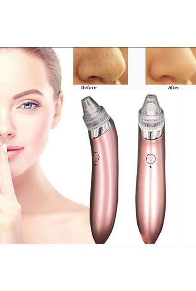 Vipstreet Evde Spa Yüz Cilt Temizleyici Siyah Nokta Gözenek Temizleme Aleti Vakumlu Mikrodermabrazyon