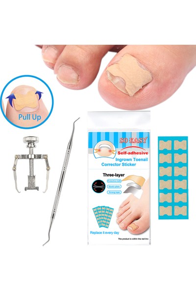 Buyfun Batık Tırnak Düzeltme Kiti Batık Ayak Tırnağı Buyfun Batık Tırnak Düzeltme Kiti Batık Ayak Tırnağı