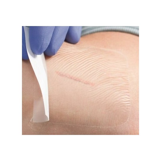 3m Tegaderm 1624 6 cm x 7 cm Su Geçirmez Film Yara Örtüsü 25 Fiyatı