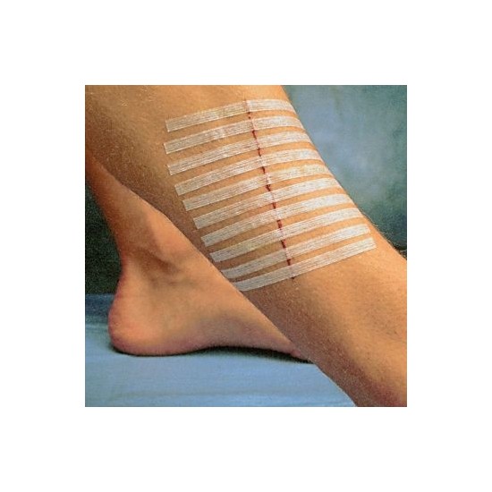 Hartmann Omnistrip Steri Strip Dikiş Bandı 12X101MM 10PAKET Fiyatı